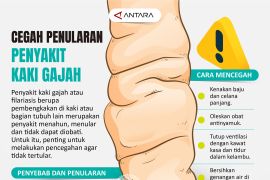 Kaki Gajah - Infografik ANTARA News