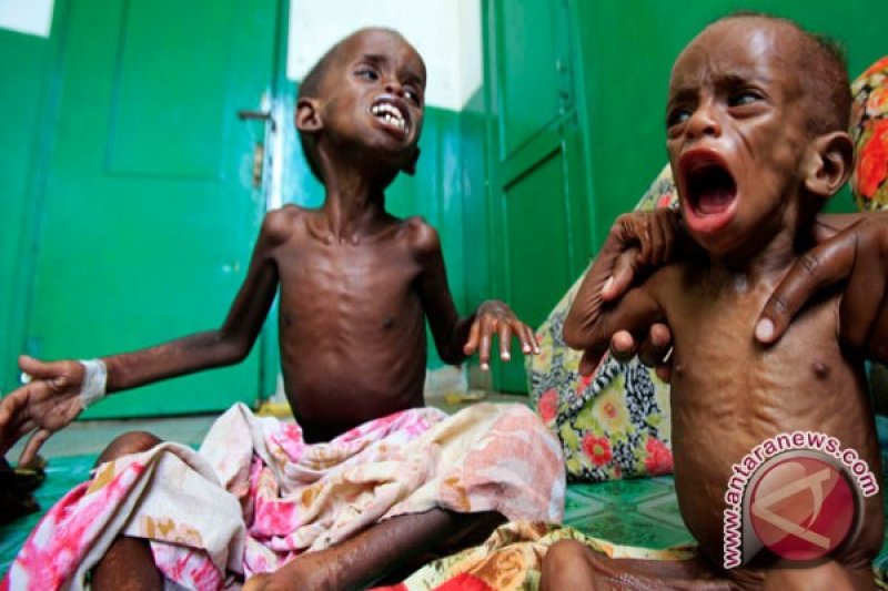 In developing world, poor still means thin - ANTARA News