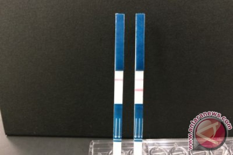 TANAKA develops ZIKA virus detection kit - ANTARA News